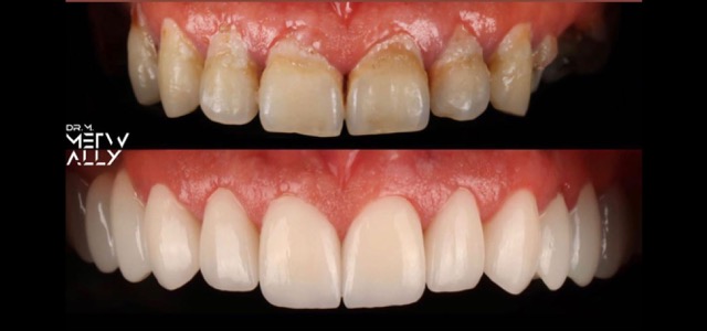 Dr. Metwally Dental Clinic | | Buy One Get One Free | The ENTERTAINER